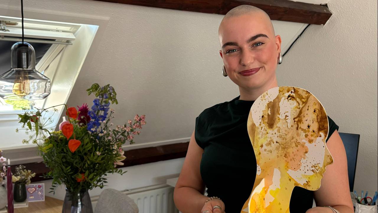 Anne (24) is al 9 jaar kaal en krijgt een prijs voor hoe ze daarmee ...